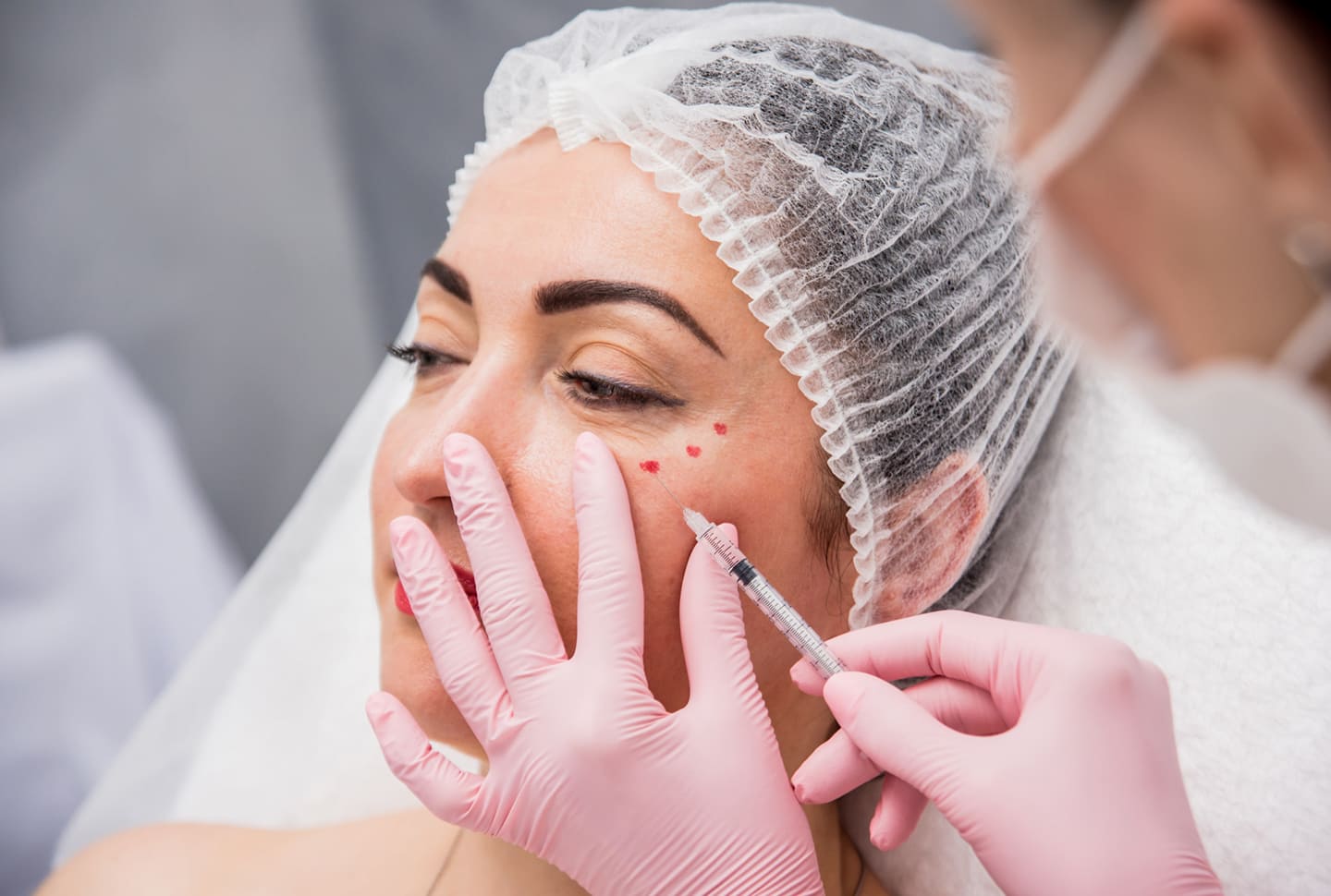 Tratamento De Manchas Melasma Espaço Valena